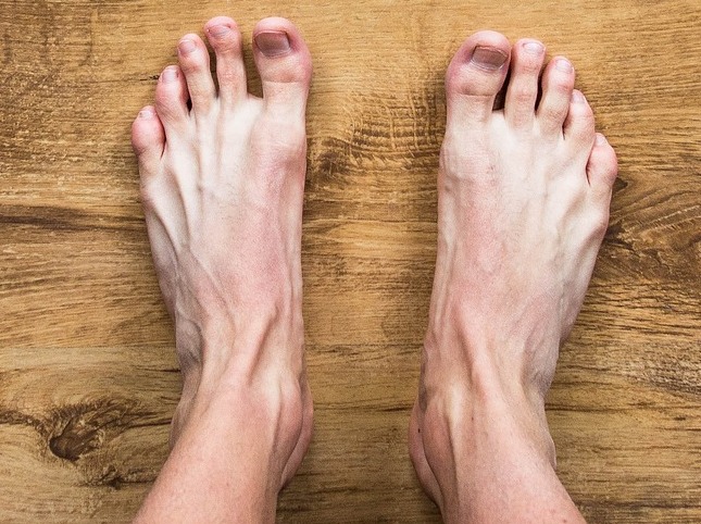 The 4-Sign & Static Leg Press Exercises for help with Orthoses - Sole ...